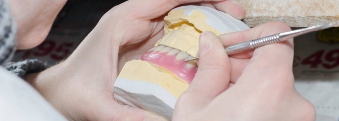 Restorative Dentistry - School of Dental Medicine - University at Buffalo