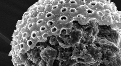 Microbial Pathogenesis of Oral Organisms - School of Dental Medicine ...